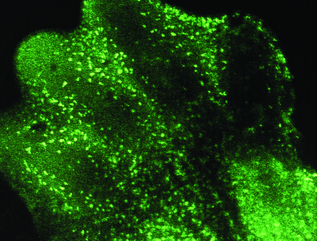 The many routes to cell death | Stanford Medicine