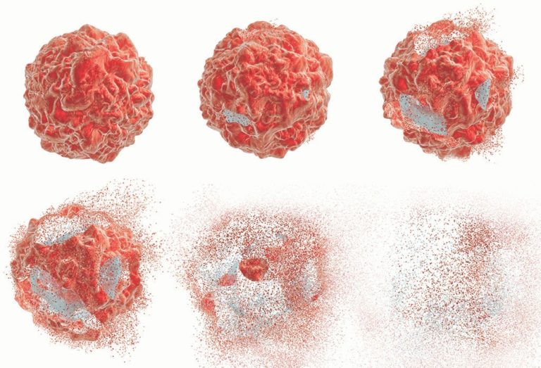 Insights into cell death could inspire disease treatments | Stanford ...