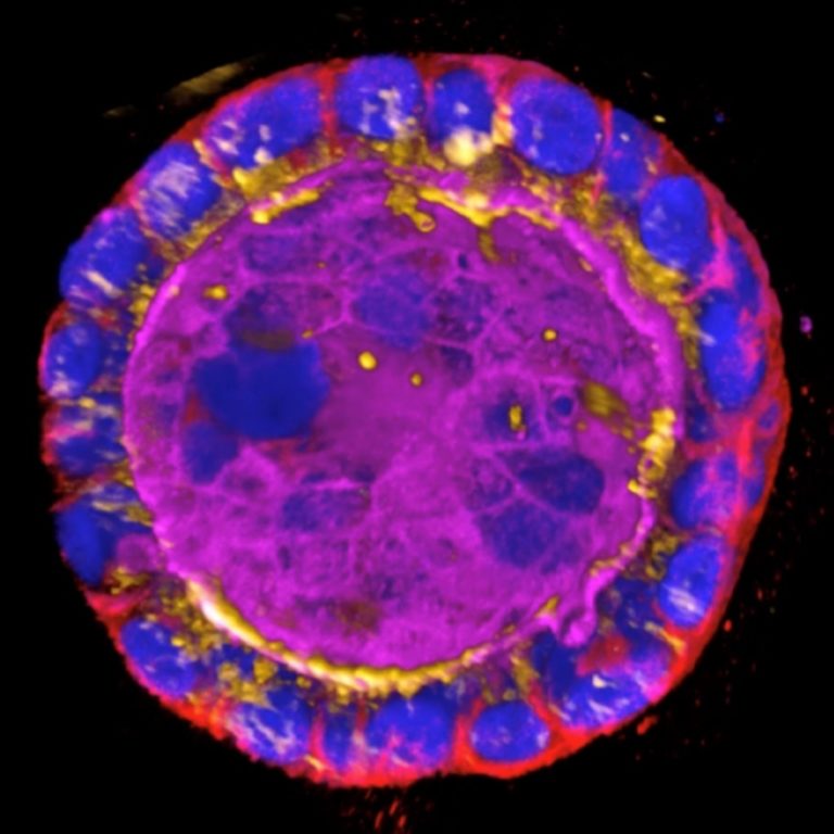 How advances in growing organoids can drive precision health | Stanford ...