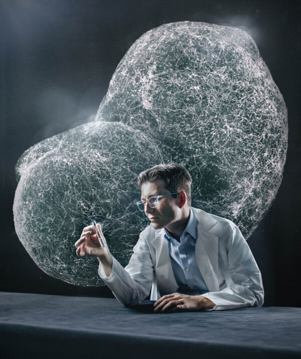 Assembloid models usher in a new era of brain science | Stanford Medicine