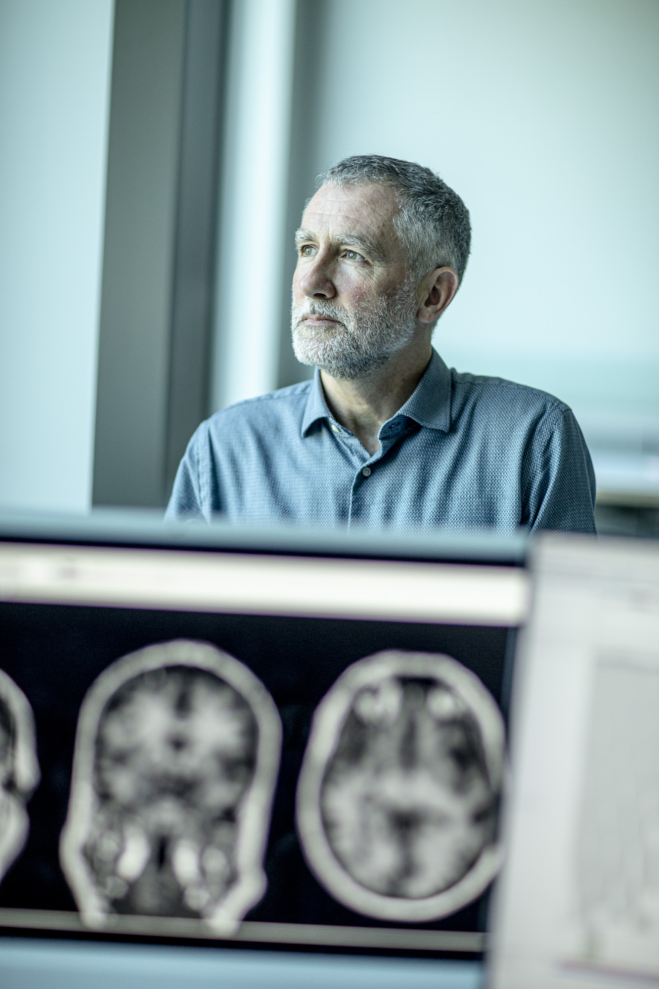 Common gene variant APOE4 offers clues for new Alzheimer’s drug